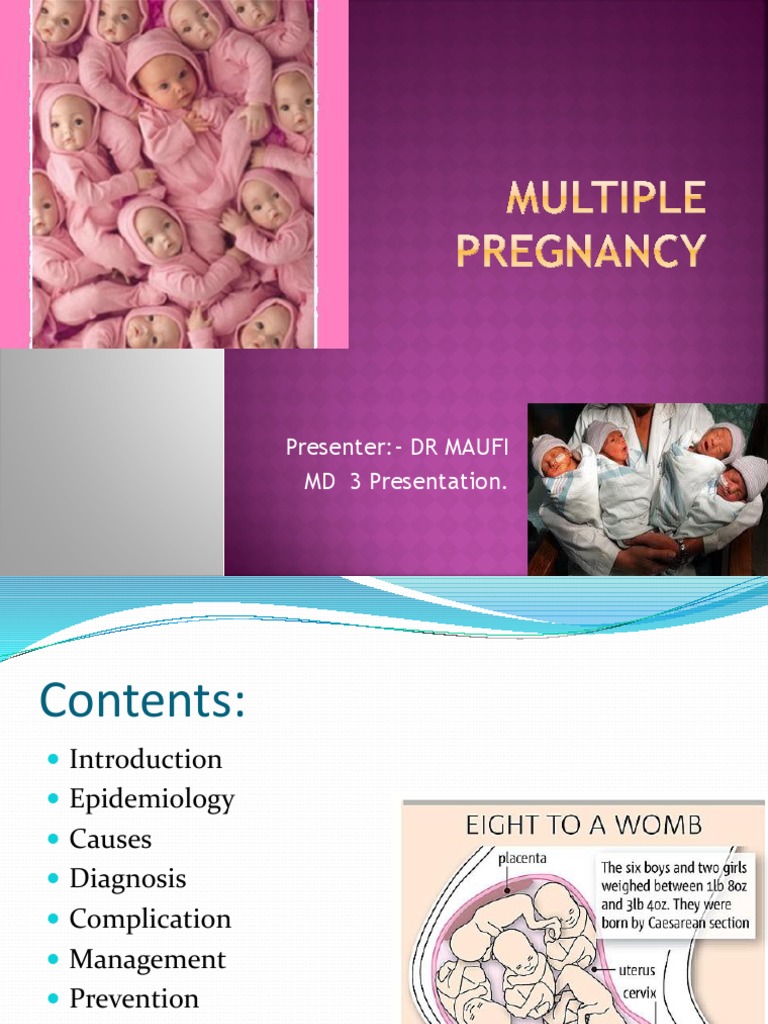 Multiple Pregnancy - PPTX Md3 | Download Free PDF | Multiple Births | Twin