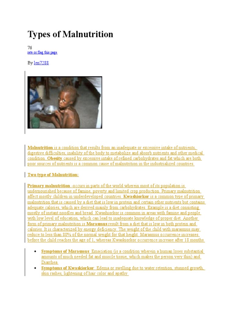 Types of Malnutrition | PDF | Malnutrition | Micronutrient