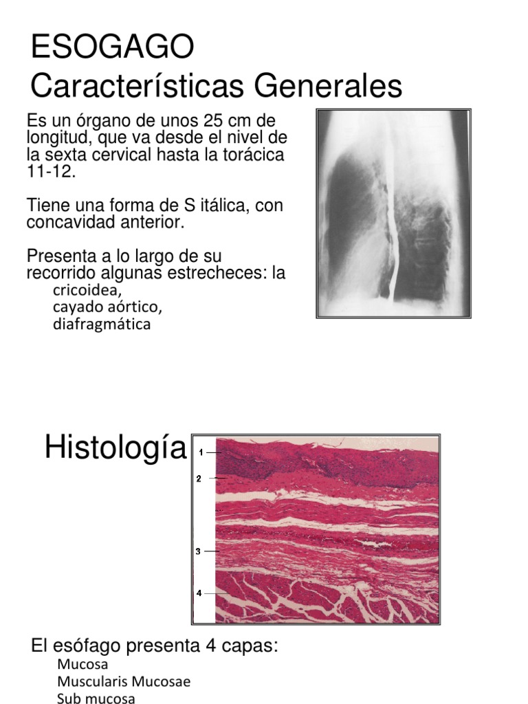 Anatomía y Patologías del Esófago | PDF | La enfermedad por reflujo ...