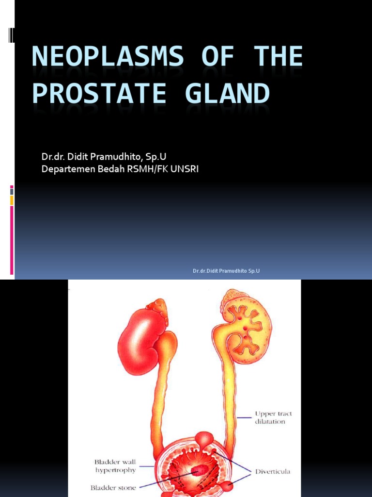 A Comprehensive Review of Benign and Malignant Neoplasms of the ...
