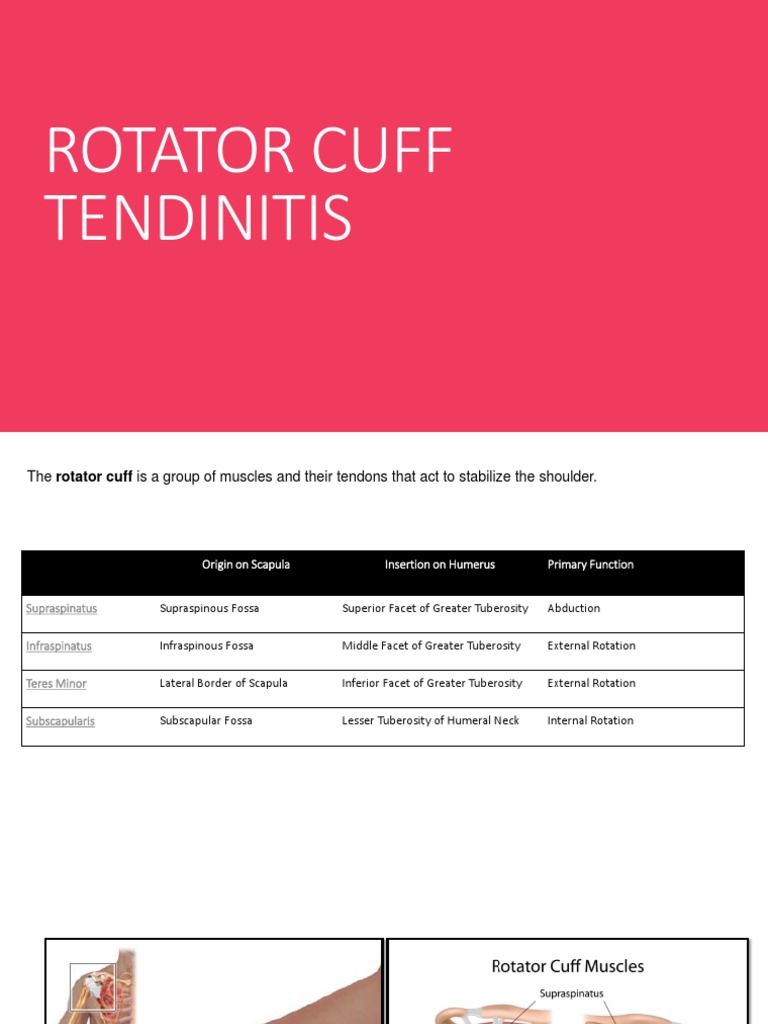 Rotator Cuff Tendinitis | Download Free PDF | Shoulder | Anatomical ...