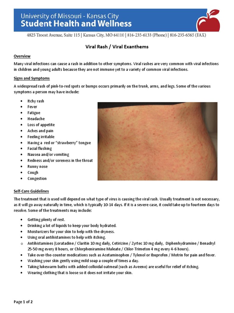 Viral Rash / Viral Exanthems | PDF | Fever | Pain