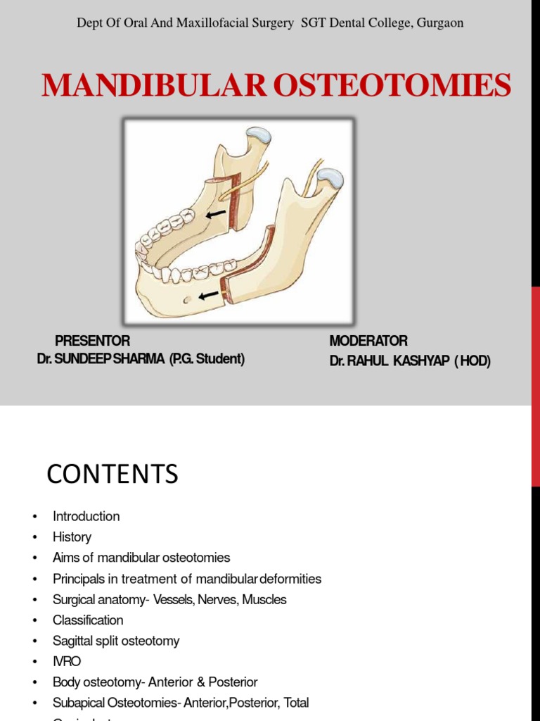 Mandibular Osteotomies Sundeep | PDF | Orthodontics | Anatomical Terms ...