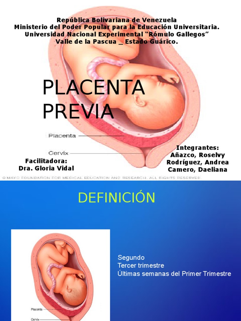 Placenta Previa | PDF | Embarazo humano | Salud pública