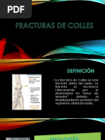 Fracturas de Colles, Smith y Barton | PDF | Traumatologia | Hueso