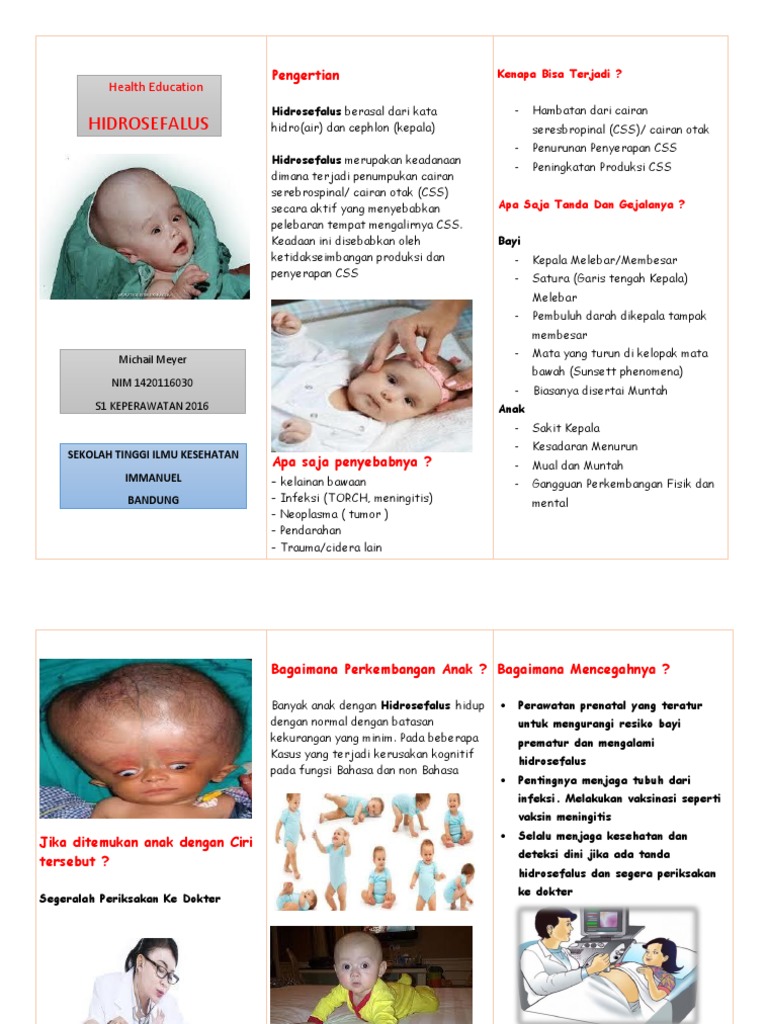 Leaflet Hidrosefalus | PDF