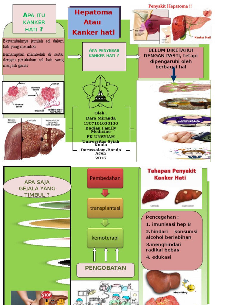 Leaflet Hepatoma | PDF