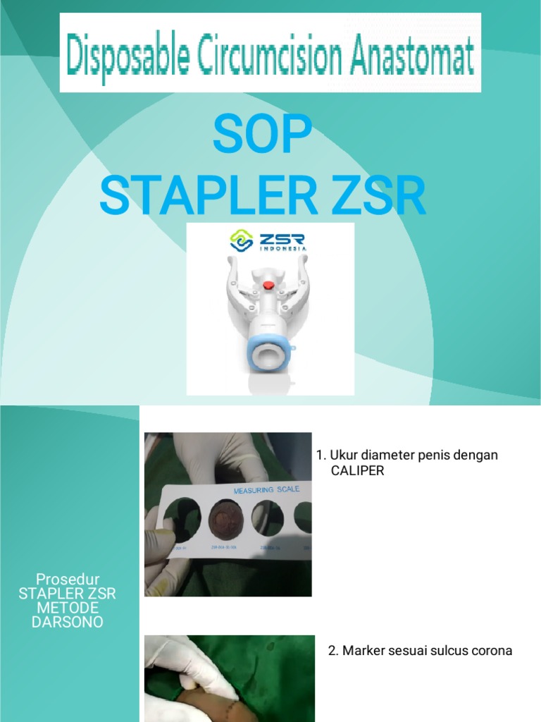 Sop Stapler ZSR | PDF
