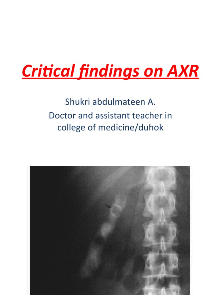 Critical Findings On AXR | PDF | Gallbladder | Abdomen