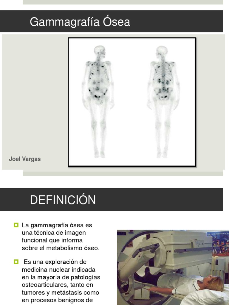 Gammagrafía Ósea: Diagnóstico y Aplicaciones | PDF | Hueso ...