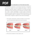Dewey-Anderson de La Clase I y III de Angle | PDF