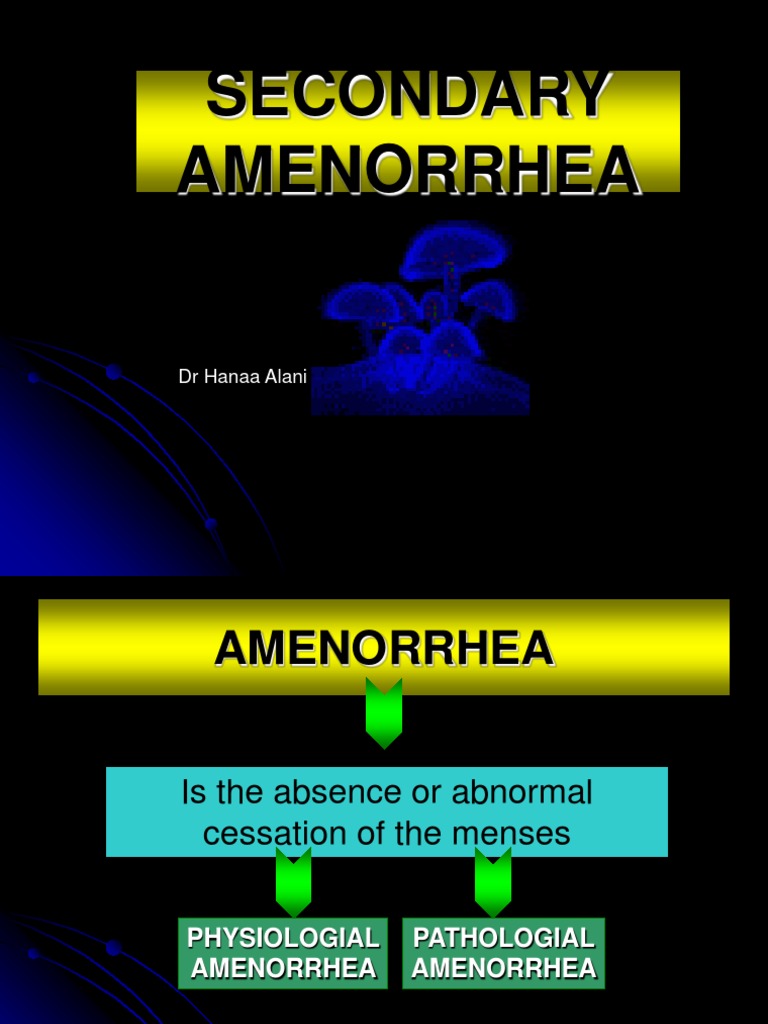 Secondary Amenorrhea | PDF | Polycystic Ovary Syndrome | Luteinizing ...