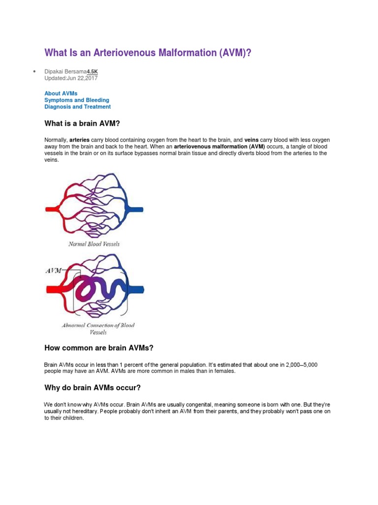 An In-Depth Overview of Arteriovenous Malformations (AVMs) of the Brain ...