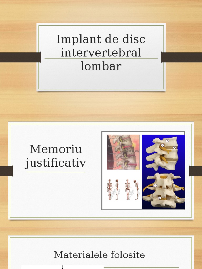 Implant de Disc Intervertebral Lombar - Odp | PDF