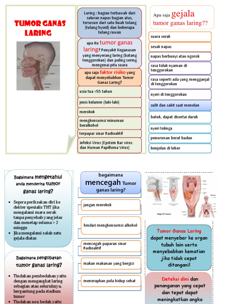 Leaflet Tumor-Ganas-Laring | PDF