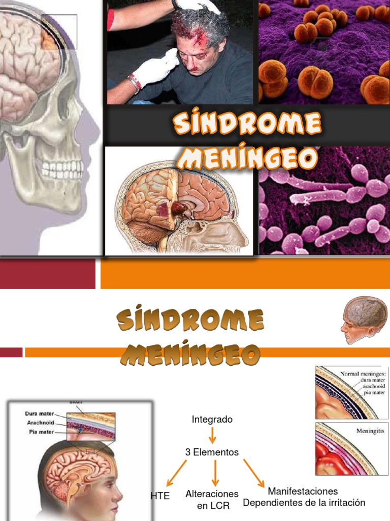 Sindrome Meningeo | PDF | Meningitis | Síntomas y signos