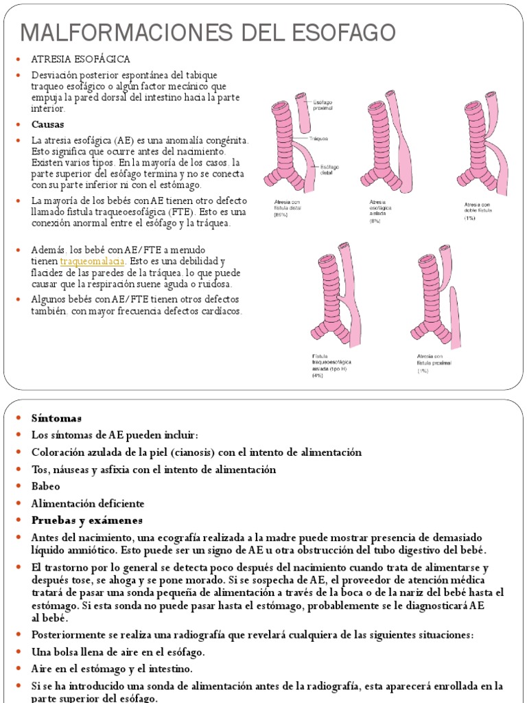 Malformaciones Del Esofago | PDF | La enfermedad por reflujo ...