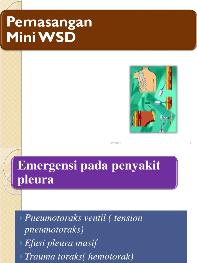 Pemasangan Mini WSD2 | PDF