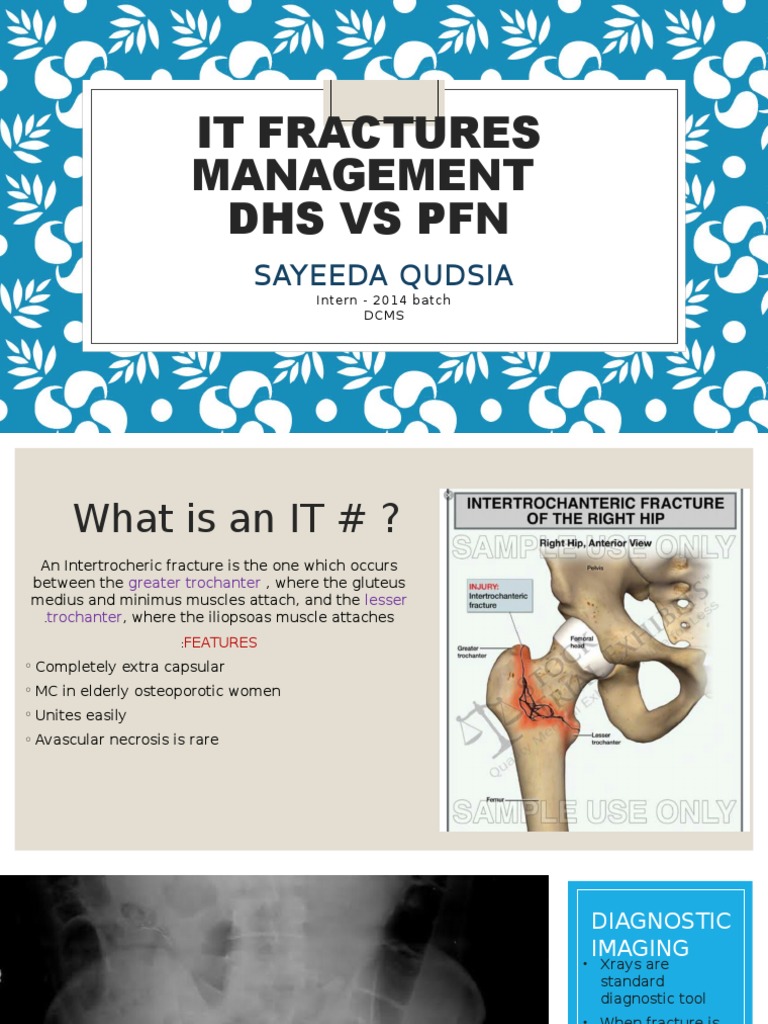 It Fractures Management Dhs Vs PFN: Sayeeda Qudsia | PDF | Hip ...