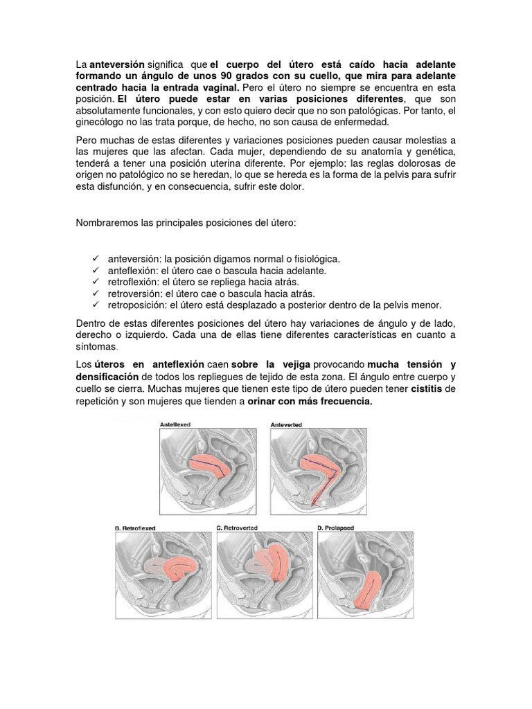 Posiciones del útero y sus efectos | PDF