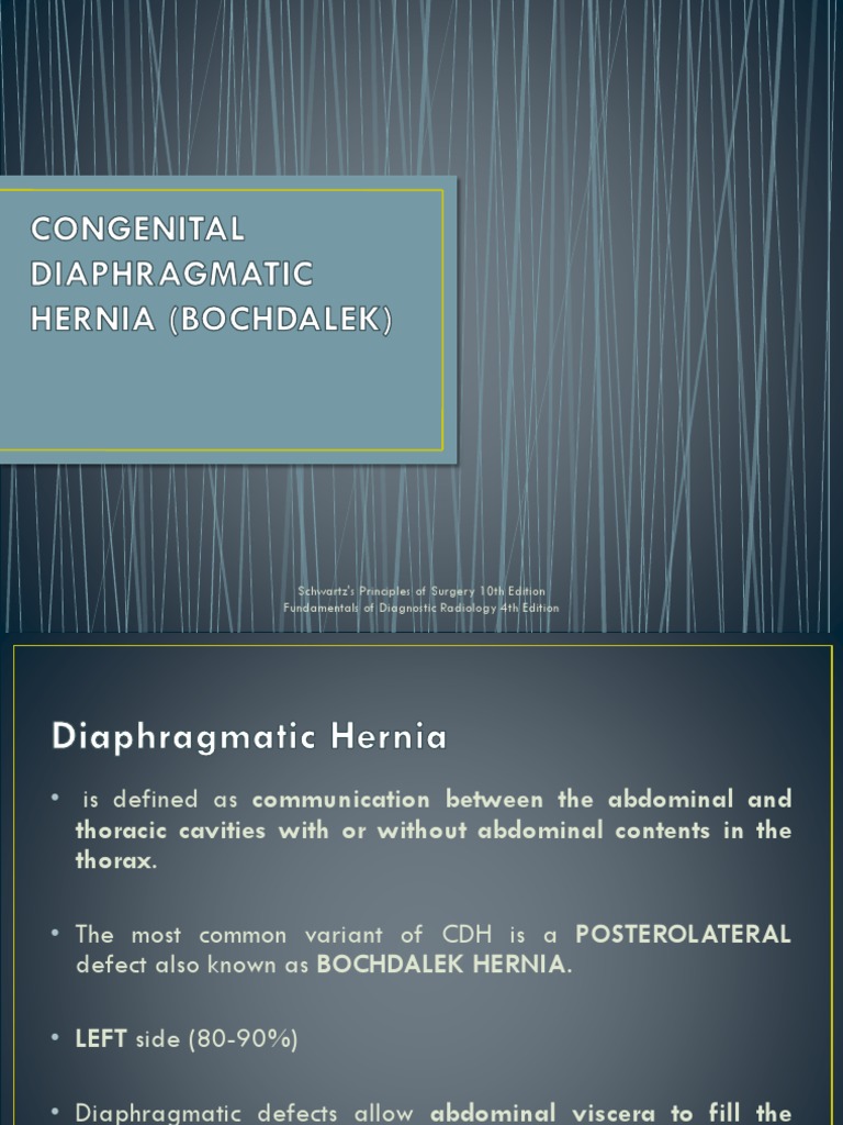Congenital Diaphragmatic Hernia (Bochdalek) | PDF
