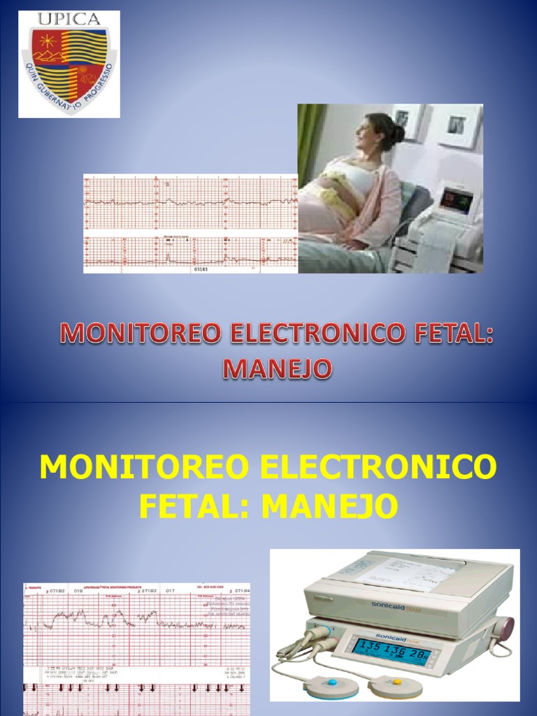 Monitoreo Electrónico Fetal y Manejo | PDF | Parto | El embarazo