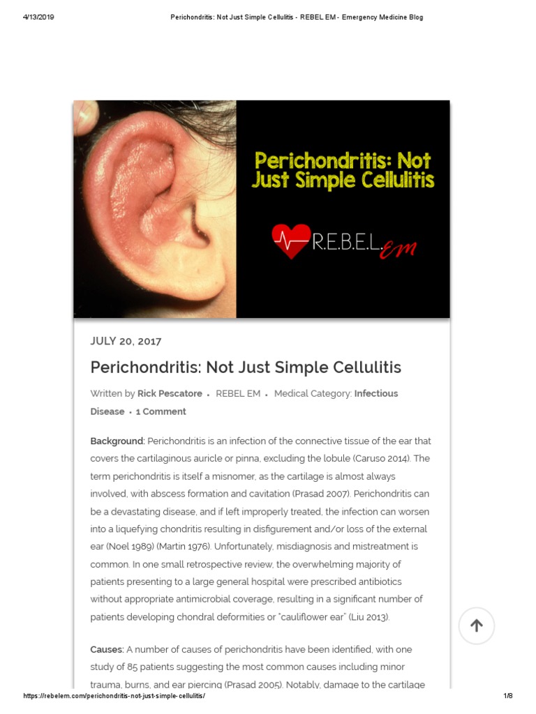 Auricular Cellulitis