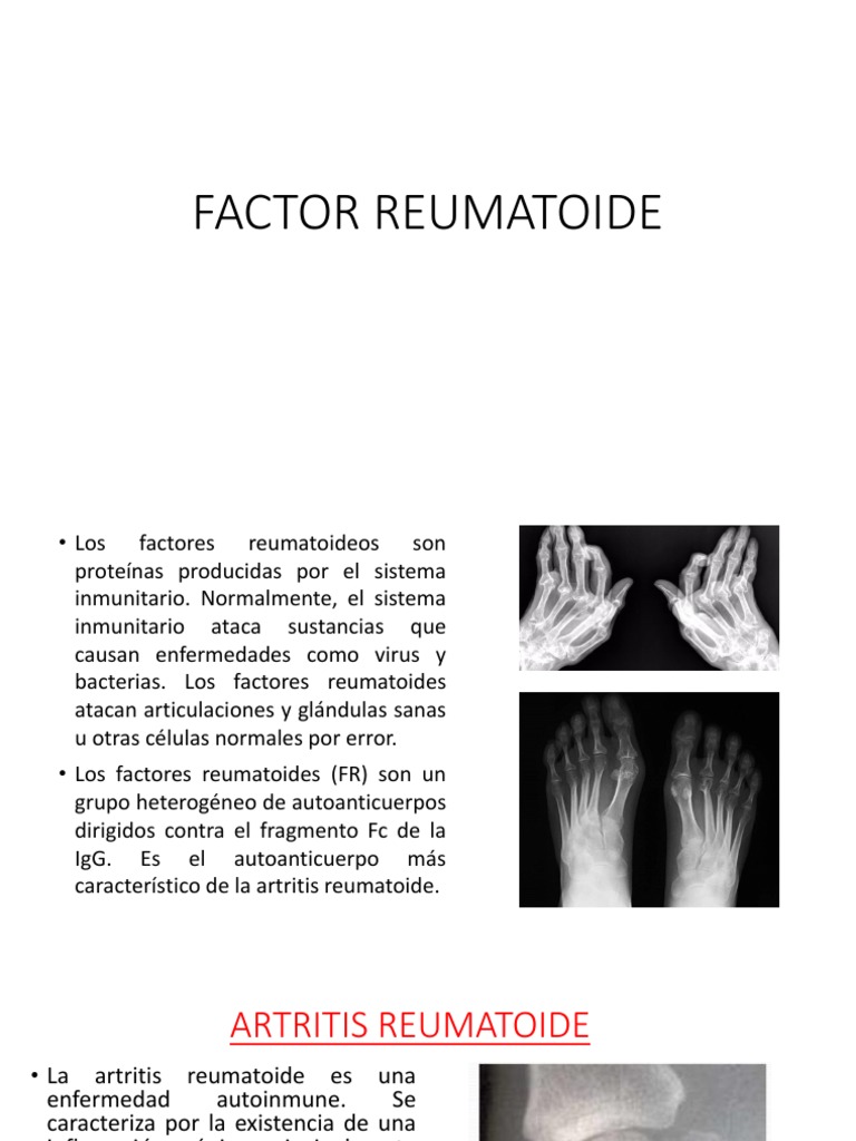 Factor Reumatoide | PDF | Artritis Reumatoide | Especialidades Medicas