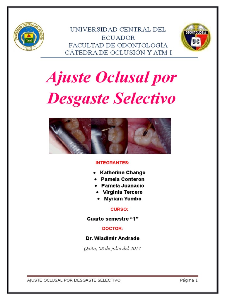 Ajuste Oclusal y Desgaste Selectivo PDF | PDF | Odontología | Boca