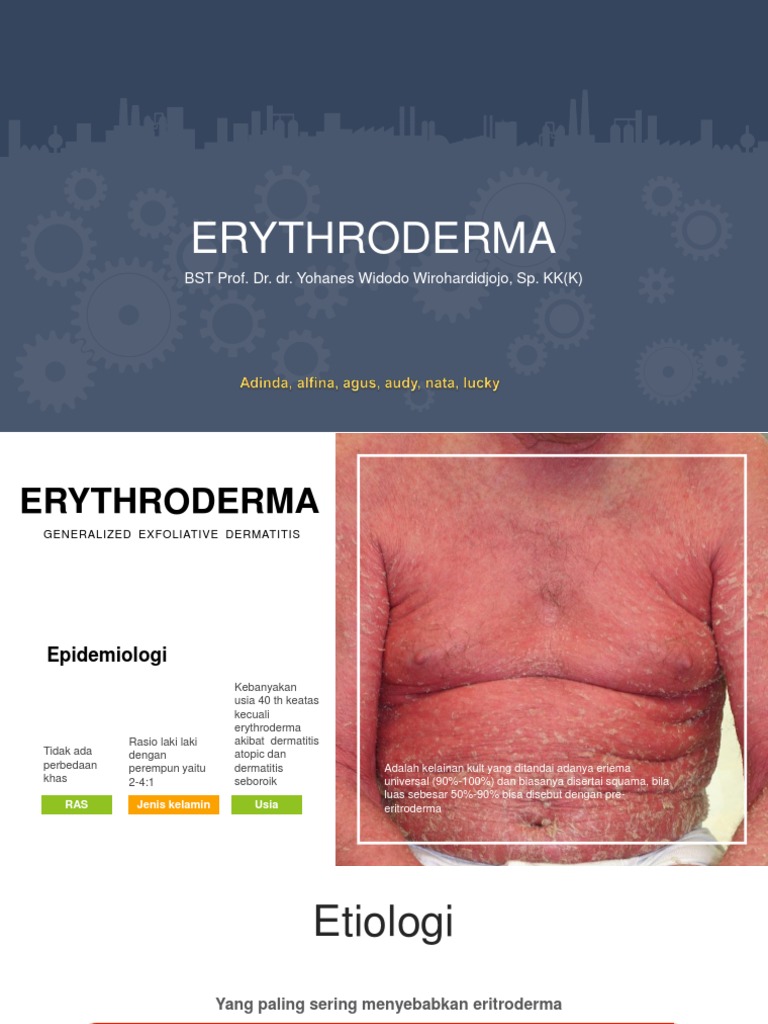 Erythroderma: Diagnosis dan Pengobatan | PDF