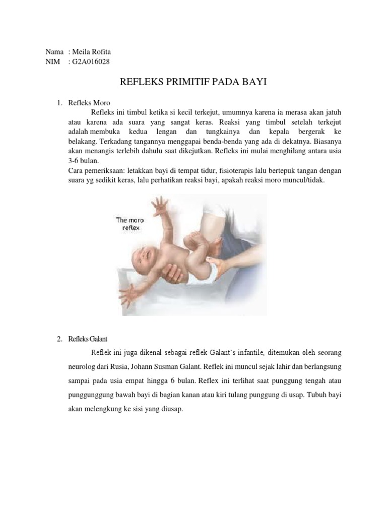 Refleks Primitif pada Bayi dan Jenisnya | PDF | Pengembangan Diri