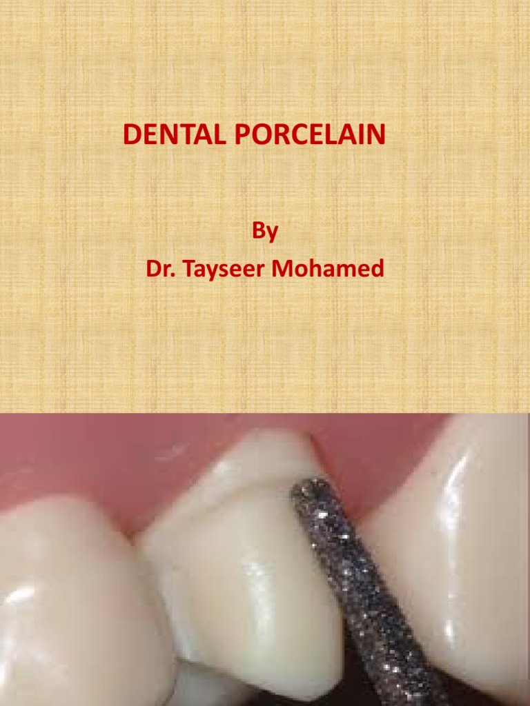 Dental Porcelain: Composition, Processing, Strengthening and ...