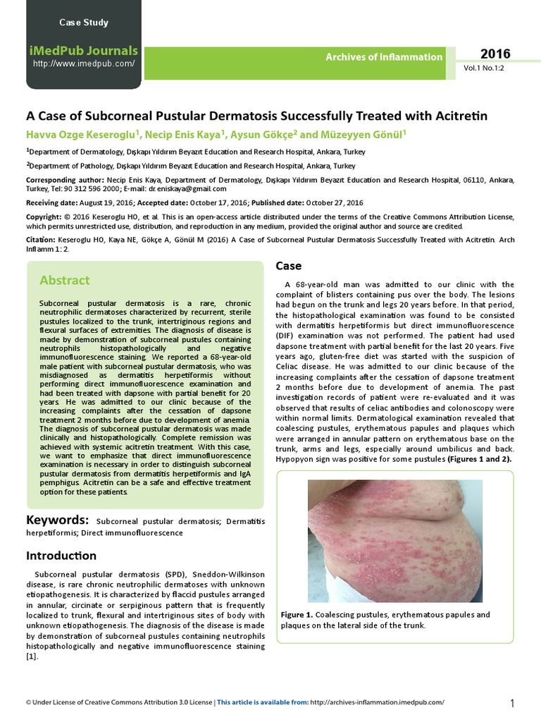A Case of Subcorneal Pustular Dermatosis Successfully Treated With ...
