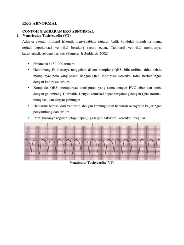 EKG ABNORMAL | PDF
