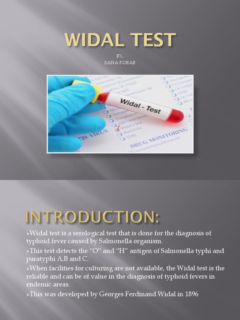 Widal Test: Principle, Procedure, Types, Requirements,, 50% OFF