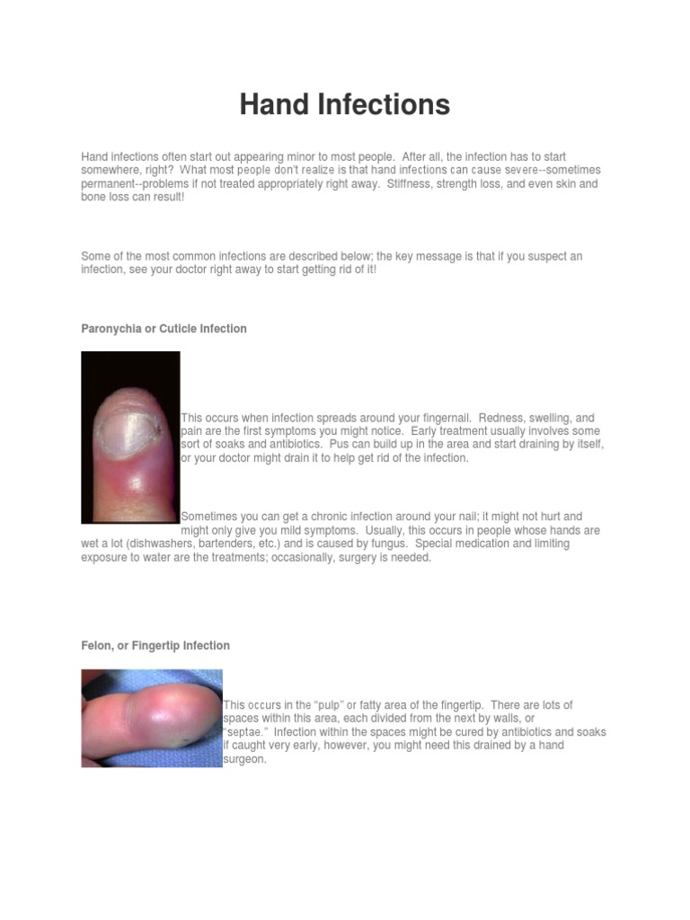 Hand Infections: Paronychia or Cuticle Infection | PDF | Infection ...