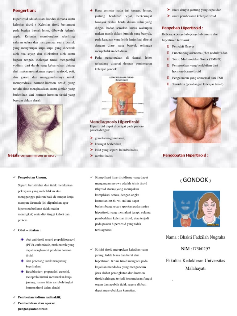 Leaflet Hipertiroid ALI | PDF