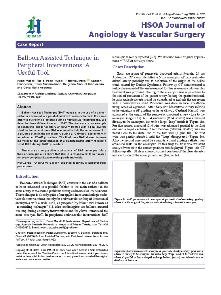 Balloon Assisted Technique in Peripheral Interventions A Useful Tool ...