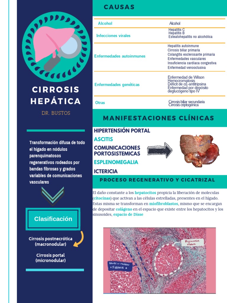 Cirrosis Hepática | PDF | Cirrosis | Hepatitis
