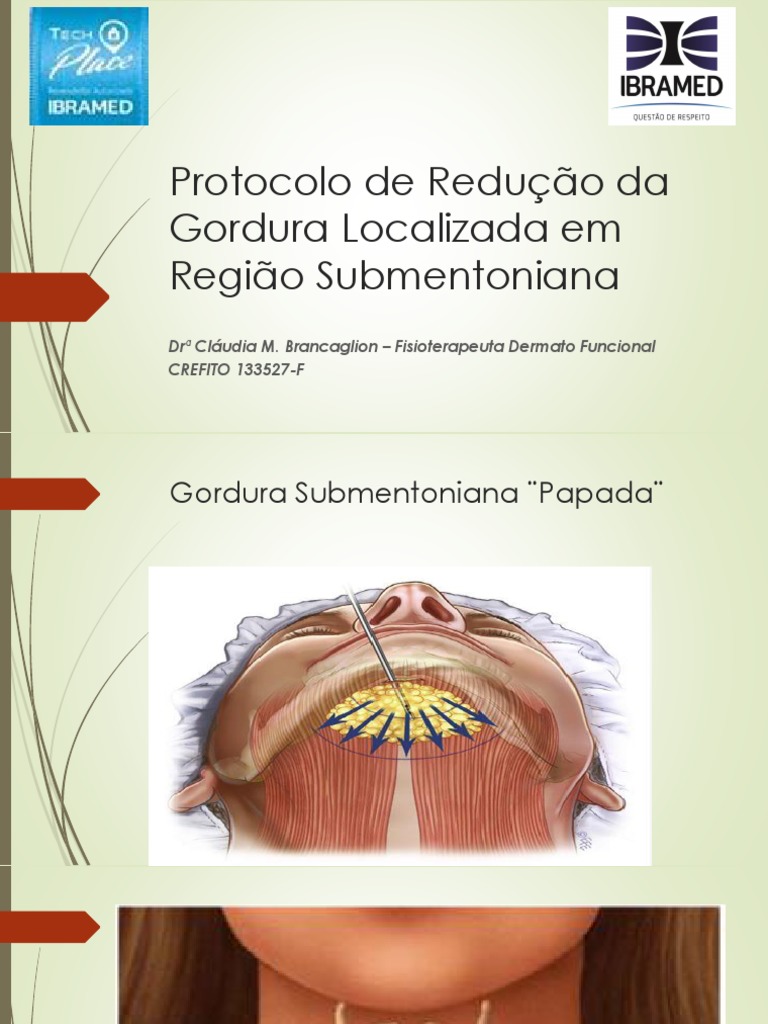 Aula Protocolo Gordura Submentoniana | PDF | Pele | Tecido adiposo