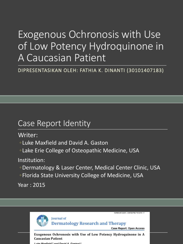 Exogenous Ochronosis With Use of Low Potency Hydroquinone in A ...