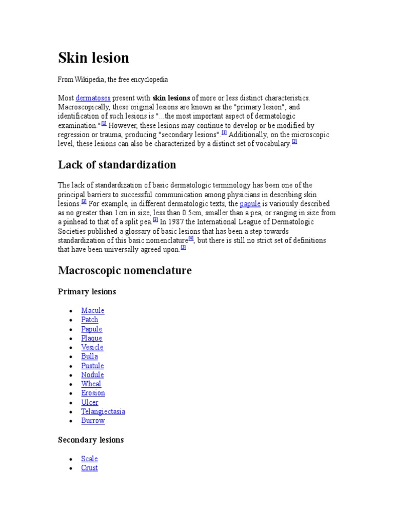 Skin Lesion | PDF | Endocrine System | Health Sciences