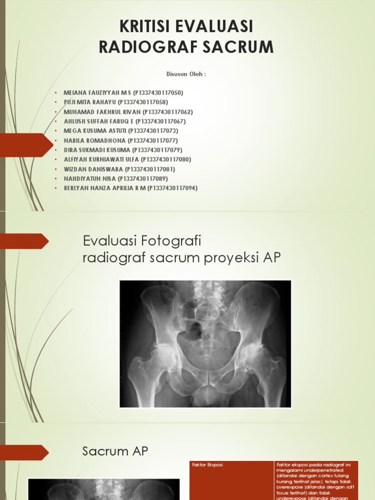 Kritisi Radiograf Sacrum | PDF