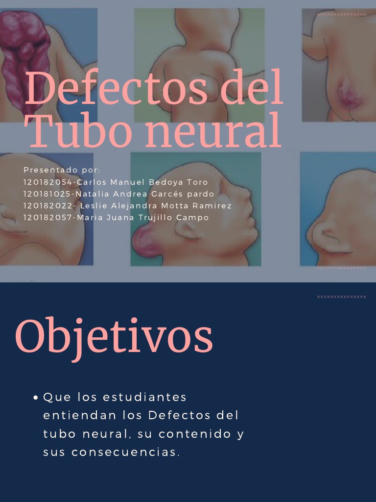 Malformaciones del tubo neural: causas y efectos | PDF | Mutación ...