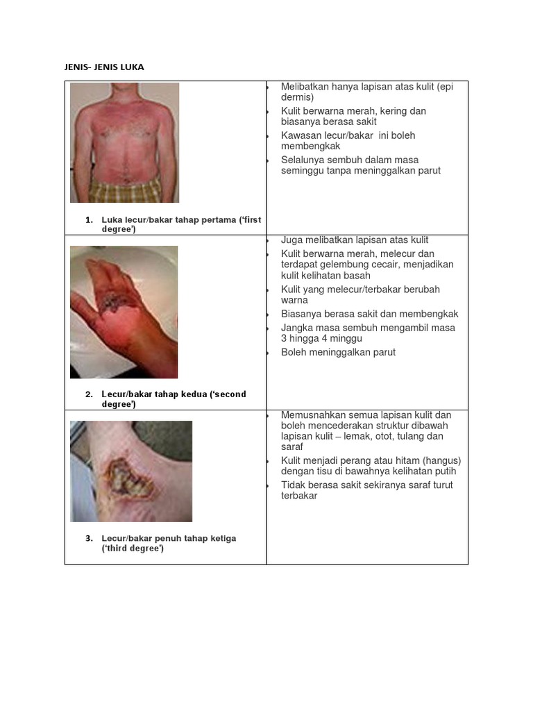 Jenis Luka | PDF