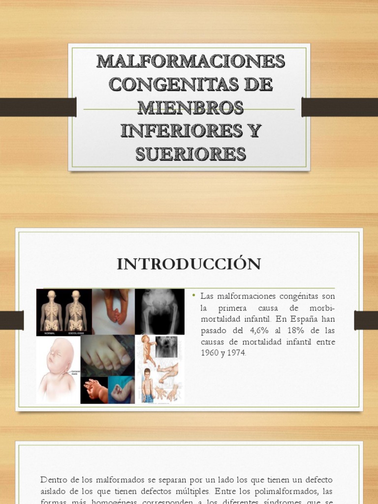 Malformaciones Congénitas en Niños | PDF | Rodilla | Mano