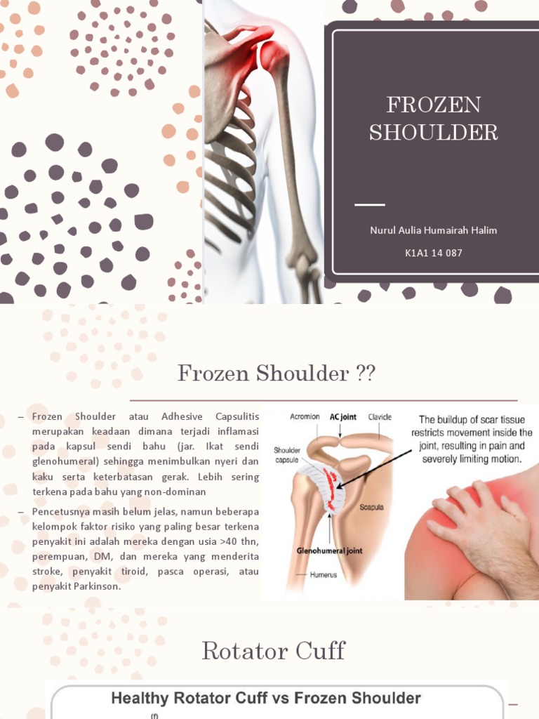 Frozen Shoulder | PDF