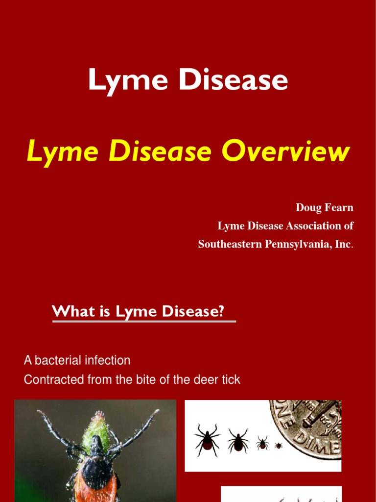 Lyme Overview | PDF | Lyme Disease | Symptom
