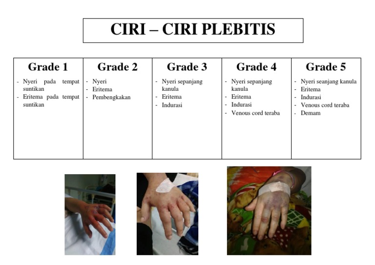 Ciri Ciri Plebitis | PDF