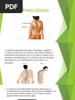 Pruebas de Galeazzi-Ellis y Signo de Adam | PDF | Salud y bienestar